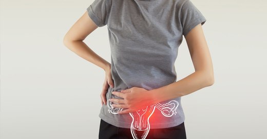 Myome natürlich mit Hilfe von Mikronährstoffen behandeln