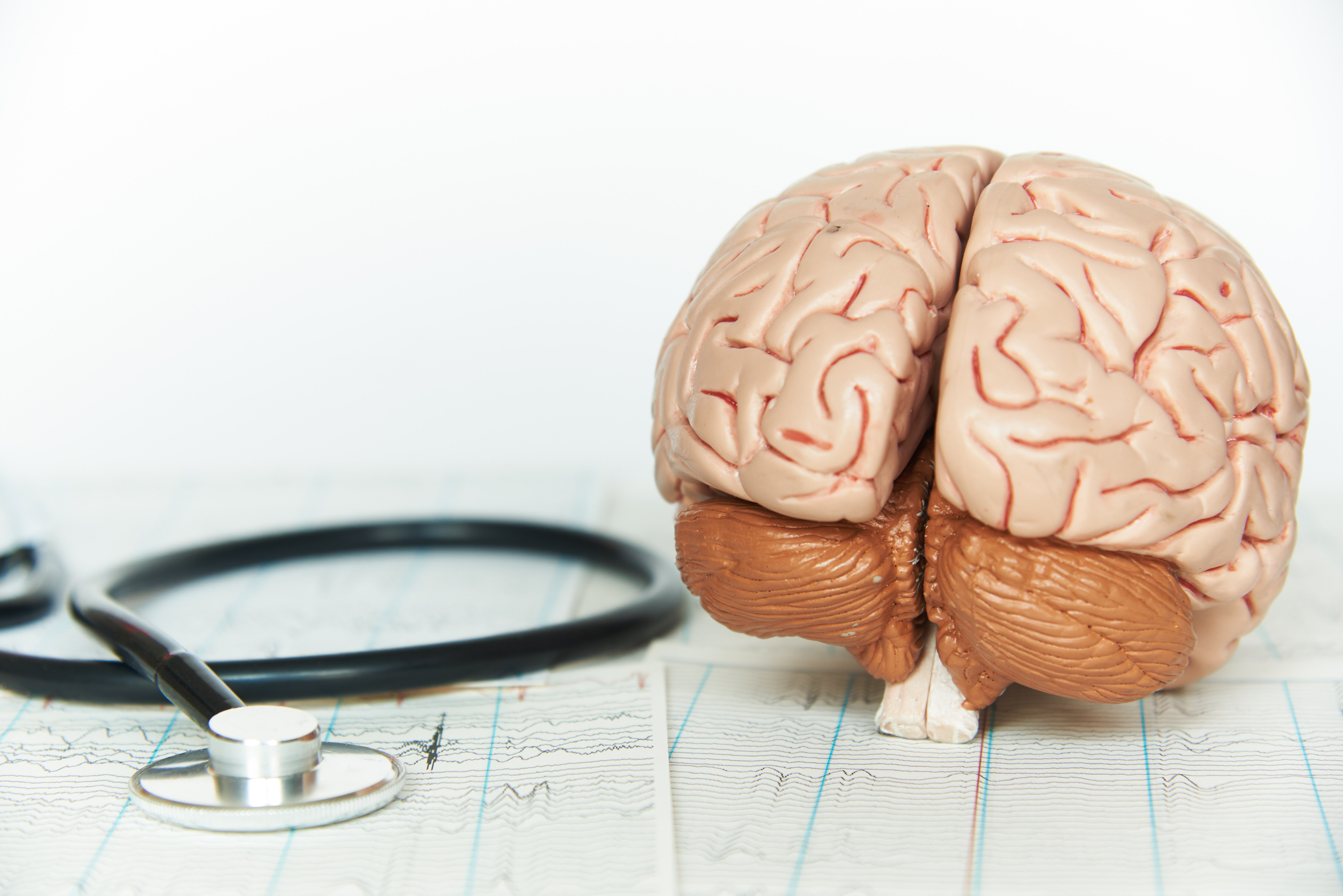 Come trattare in modo naturale l’epilessia