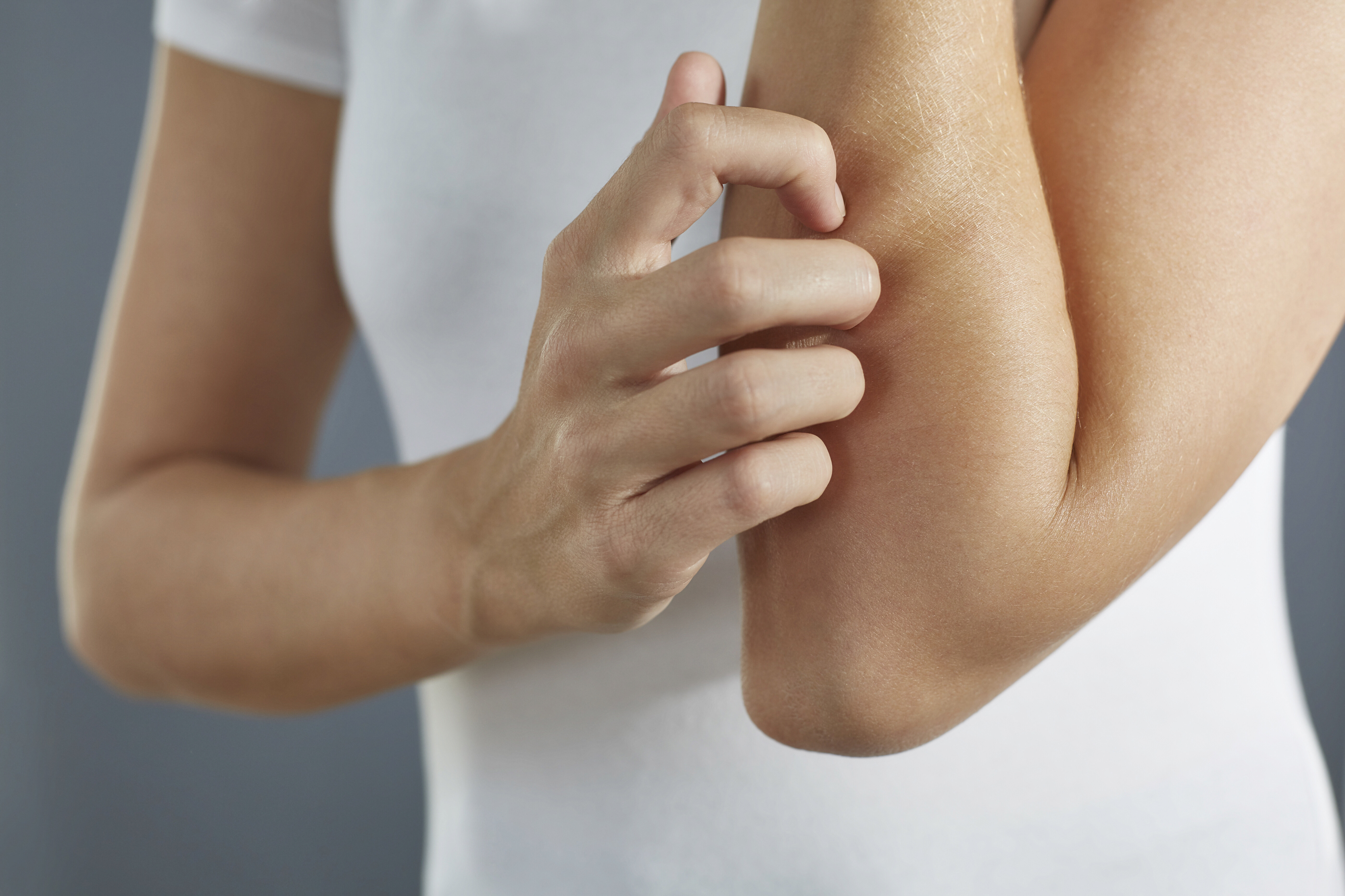 Neurodermitis - das verbessert die Haut